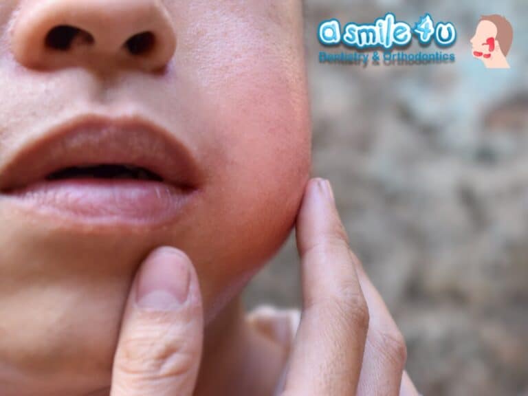 Jaw Tumors and Cysts: Causes and Treatments - A Smile 4 U