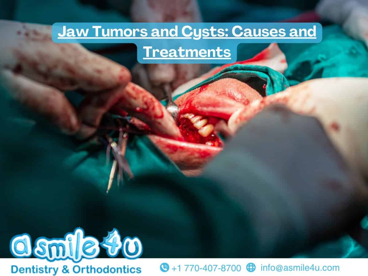 Jaw Tumors and Cysts: Causes and Treatments - A Smile 4 U